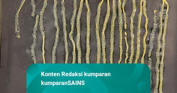 Cacing Pita 2,8 Meter Ditemukan dalam Tubuh Pasien di Singapura ... Cacing Pita 2,8 Meter Ditemukan dalam Tubuh Pasien di Singapura ...